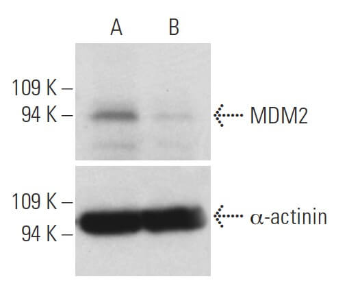 Anti-MDM2 Antibody (D-12) | SCBT - Santa Cruz Biotechnology