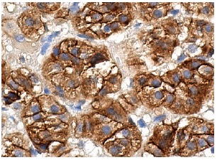 Anti-MDR1/ABCB1 Antibody (D-11) | SCBT - Santa Cruz Biotechnology