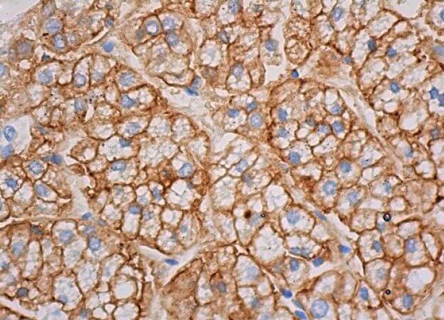 Anti-MDR1/ABCB1 Antibody (D-11) | SCBT - Santa Cruz Biotechnology