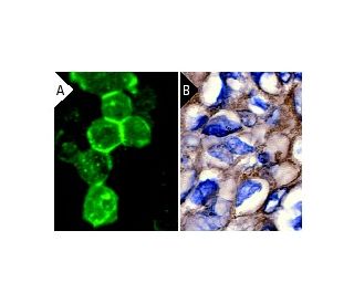 Anti-MDR1/ABCB1 Antibody (G-1) | SCBT - Santa Cruz Biotechnology