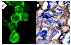 Anti-MDR1/ABCB1 Antibody (G-1) | SCBT - Santa Cruz Biotechnology
