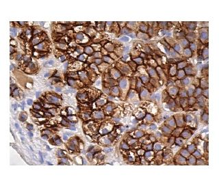 Anti-MDR1/ABCB1 Antibody (G-1) | SCBT - Santa Cruz Biotechnology