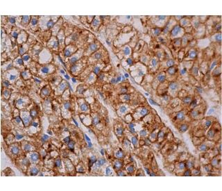 Anti-MDR1/ABCB1 Antibody (G-1) | SCBT - Santa Cruz Biotechnology