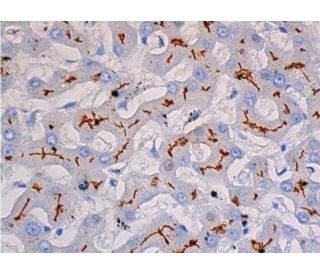 Anti-MDR1/ABCB1 Antibody (G-1) | SCBT - Santa Cruz Biotechnology