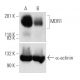 Anti-MDR1/ABCB1 Antibody (G-1) | SCBT - Santa Cruz Biotechnology
