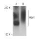 Anti-MDR1/ABCB1 Antibody (G-1) | SCBT - Santa Cruz Biotechnology