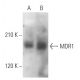 Anti-MDR1/ABCB1 Antibody (G-1) | SCBT - Santa Cruz Biotechnology