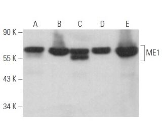 ME1 Antibody (C-6) | SCBT - Santa Cruz Biotechnology