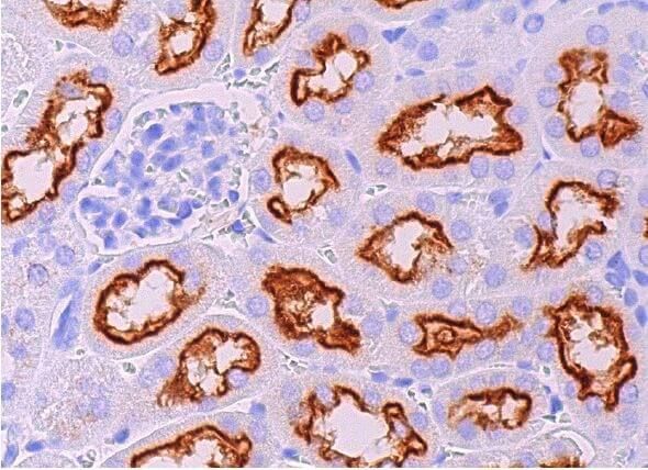 megalin Antibody (P-20) | SCBT - Santa Cruz Biotechnology