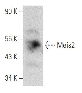 Meis2抗体 (H-10) | SCBT - Santa Cruz Biotechnology