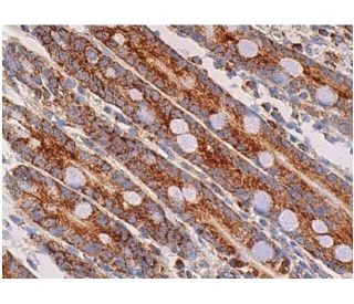 MEK-2 Antibody (A-1) | SCBT - Santa Cruz Biotechnology