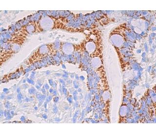 MEK-2 Antibody (A-1) | SCBT - Santa Cruz Biotechnology