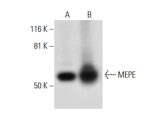 MEPE Antibody (B-6) | SCBT - Santa Cruz Biotechnology