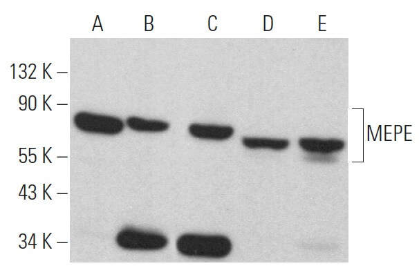MEPE Antibody (B-6) | SCBT - Santa Cruz Biotechnology