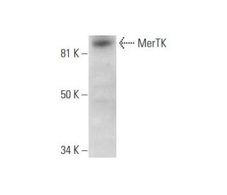 MerTK Antibody (B-1) - Western Blotting - Image 293051