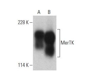 MerTK Antibody (B-1) - Western Blotting - Image 395673