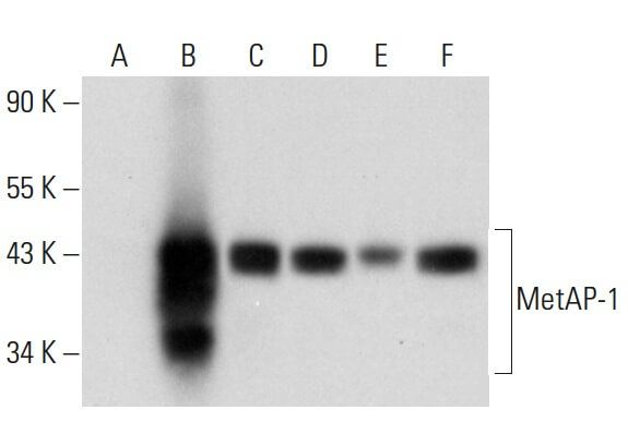 MetAP-1 Antibody (A-2) | SCBT - Santa Cruz Biotechnology