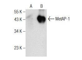 MetAP-1 Antibody (G-1) | SCBT - Santa Cruz Biotechnology
