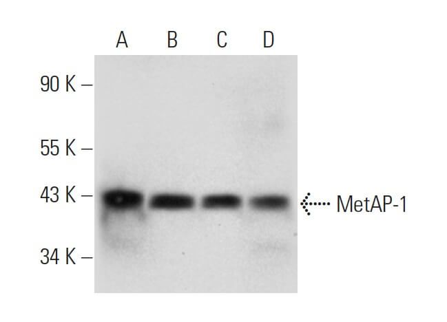 MetAP-1 Antibody (G-9) | SCBT - Santa Cruz Biotechnology