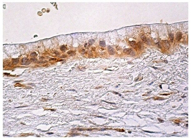 MetAP-2 Antibody (B-8) | SCBT - Santa Cruz Biotechnology