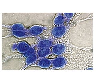 Methyl Green: sc-215348. Staining of methanol fixed NIH/3T3 cells ...