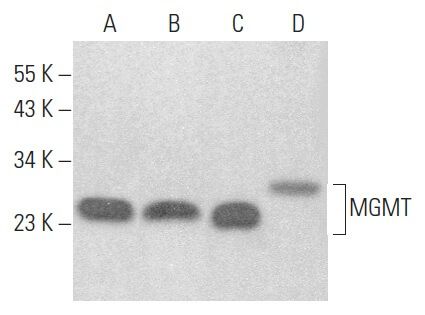 MGMT Antibody (MT5.1) | SCBT - Santa Cruz Biotechnology