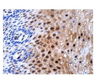 Mi2 Antibody (B-4) - Immunohistochemistry - Image 156847