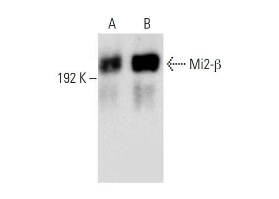 Mi2 Antibody (H-242) | SCBT - Santa Cruz Biotechnology