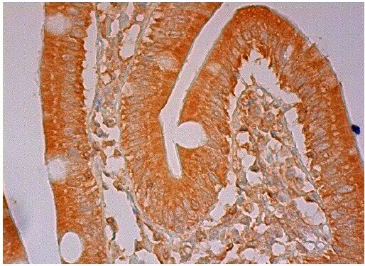 Anti-MIC1 Antibody (D-7) | SCBT - Santa Cruz Biotechnology