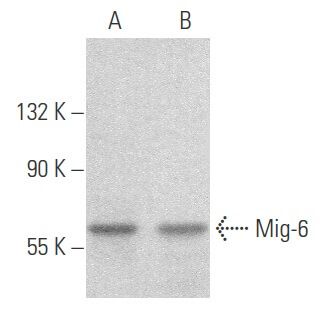 Mig-6 Antibody (D-1) | SCBT - Santa Cruz Biotechnology