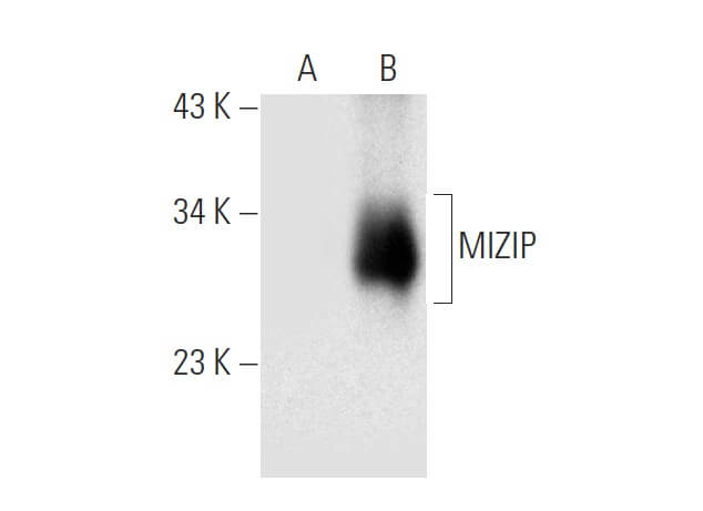 MIZIP Antibody (E-4) | SCBT - Santa Cruz Biotechnology