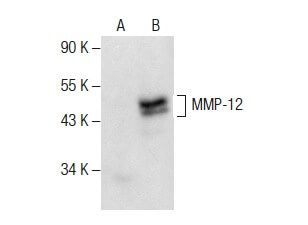 MMP-12 Antibody (H-9) | SCBT - Santa Cruz Biotechnology