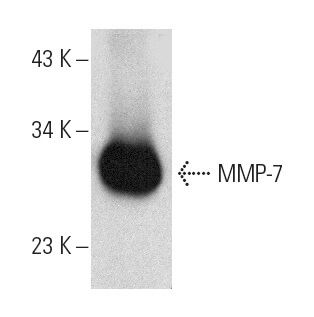 MMP-7 Antibody (A-5) | SCBT - Santa Cruz Biotechnology