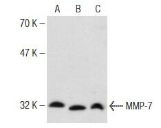 MMP-7 Antibody (JL07) | SCBT - Santa Cruz Biotechnology