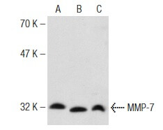 Anti-MMP-7 Antibody (JL07) | SCBT - Santa Cruz Biotechnology