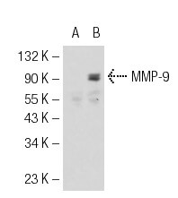 MMP-9 Antibody (6-6B) | SCBT - Santa Cruz Biotechnology
