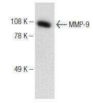 MMP9 Antibody (7-11C) | SCBT - Santa Cruz Biotechnology