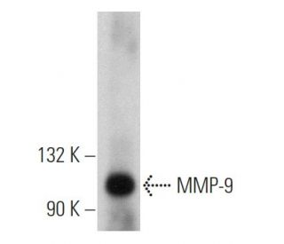 MMP-9 Antibody (7-11C) - Western Blotting - Image 360386