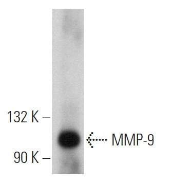 Anti-MMP-9 Antibody (7-11C) | SCBT - Santa Cruz Biotechnology