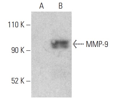 MMP-9 Antibody (7-11C) | SCBT - Santa Cruz Biotechnology