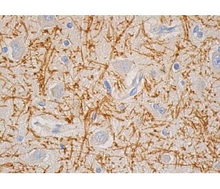 MOG Antibody (D-10) - Immunohistochemistry - Image 388756