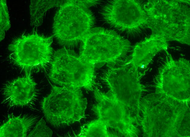 mouse anti-rabbit IgG-CFL 488 Secondary Antibody | SCBT - Santa Cruz ...