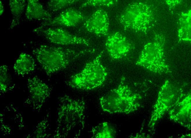 mouse anti-rabbit IgG-FITC Secondary Antibody | SCBT - Santa Cruz ...