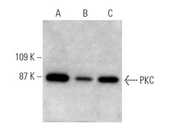 mouse anti-rabbit IgG-HRP Secondary Antibody | SCBT - Santa Cruz ...