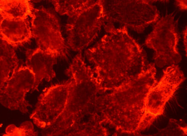 mouse anti-rabbit IgG-PE Secondary Antibody | SCBT - Santa Cruz ...