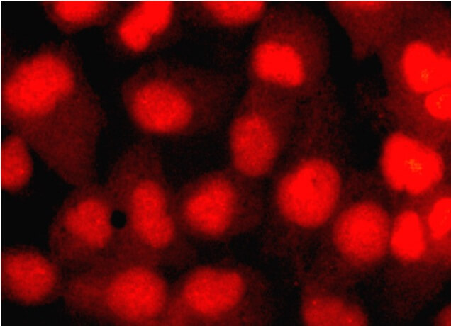 mouse anti-rabbit IgG-R Secondary Antibody | SCBT - Santa Cruz ...