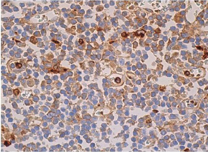 MPO light chain/Myeloperoxidase Antibody (A-5) | SCBT - Santa Cruz ...