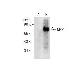 MPP2 Antibody (D-9) | SCBT - Santa Cruz Biotechnology