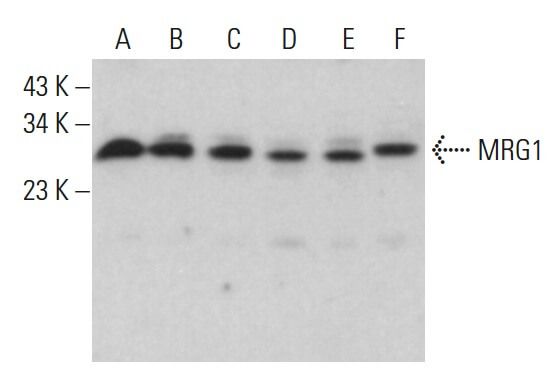 MRG1 Antibody (JA22) | SCBT - Santa Cruz Biotechnology
