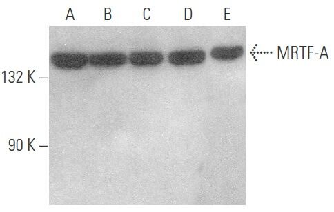 MRTF-A/MKL1抗体 (G-7) | SCBT - Santa Cruz Biotechnology